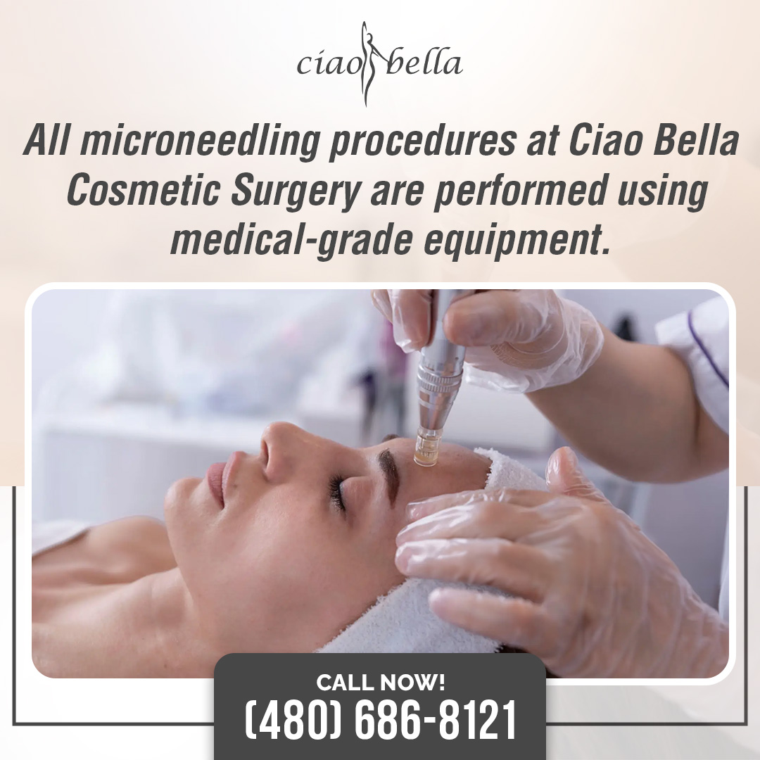 Microneedling for Acne Scars: How Many Sessions Do You Need? - Ciao ...